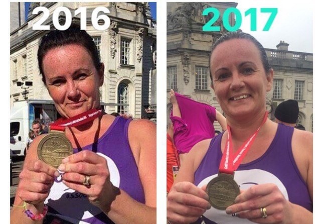 Janine P - Psoriasis Association